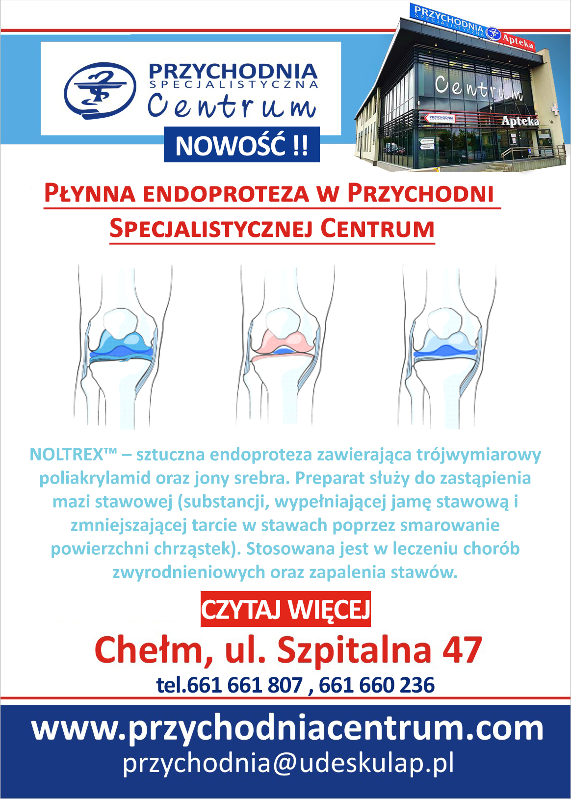 NOLTREX™ – sztuczna endoproteza zawierająca trójwymiarowy poliakrylamid ...